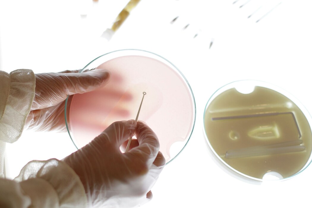 The designer using bacteria infused textiles to tackle vaginal ...