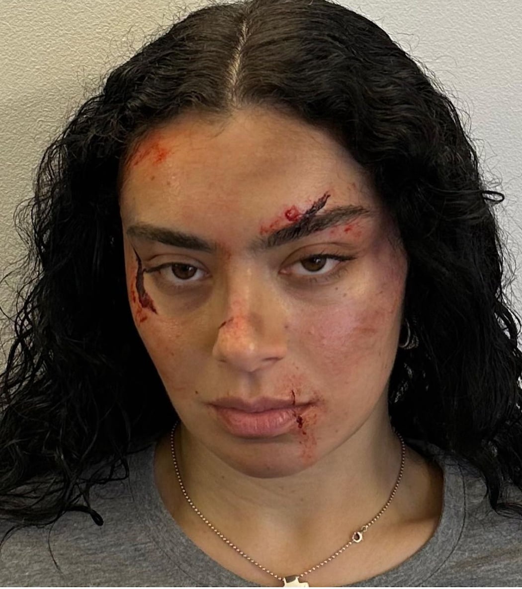 Pain is beauty: How injury became a make-up trend | Dazed