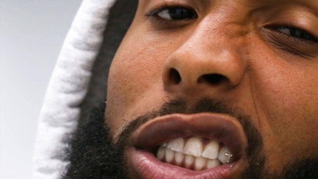 A Brief History of Teeth | Dazed