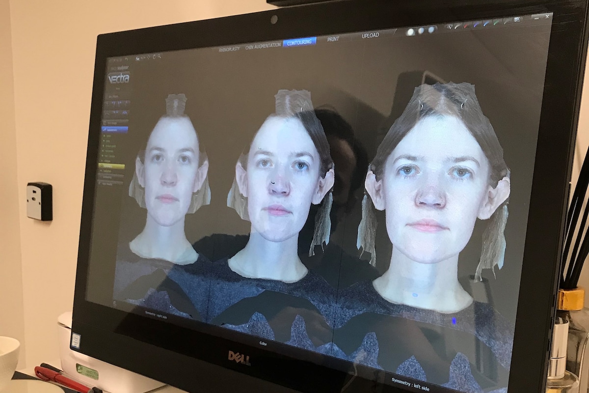 I had my face 3D imaged and lasered in search of symmetry | Dazed