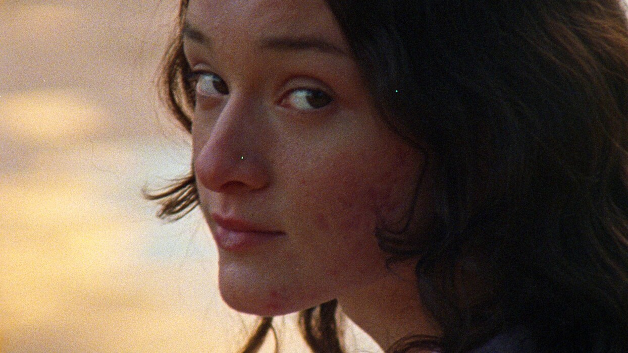 Skin deep: this film explores what it’s like living with a skin ...