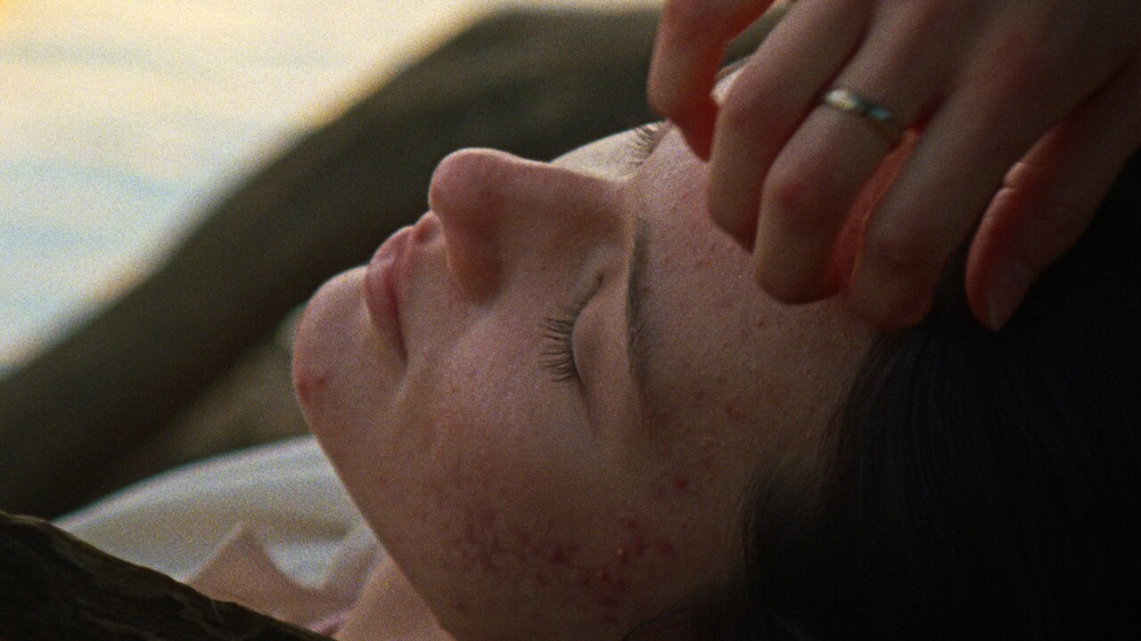 Skin deep: this film explores what it’s like living with a skin ...