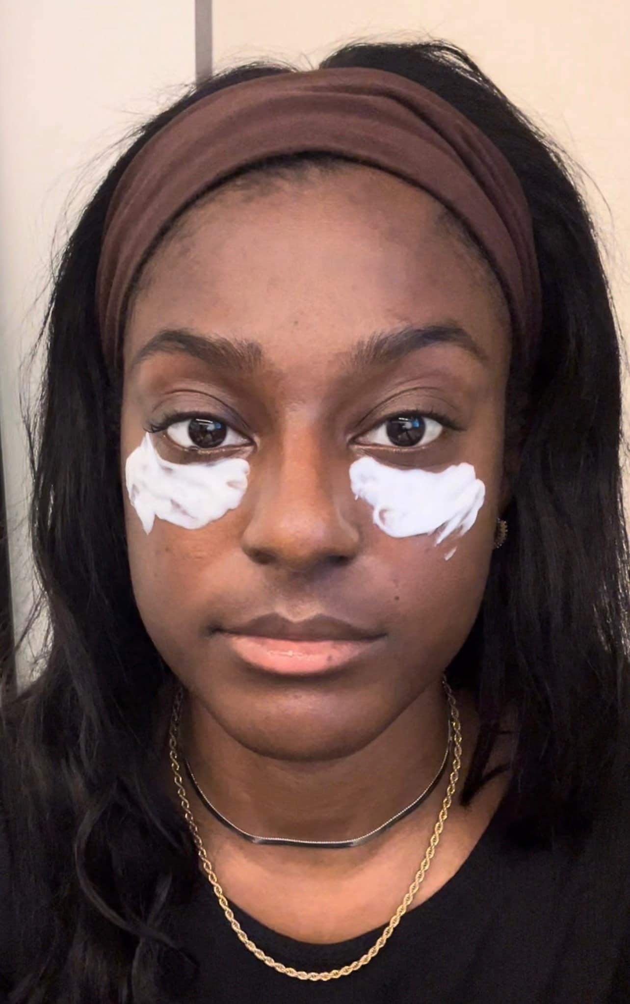 I injected salmon sperm into my face – these were the results | Dazed