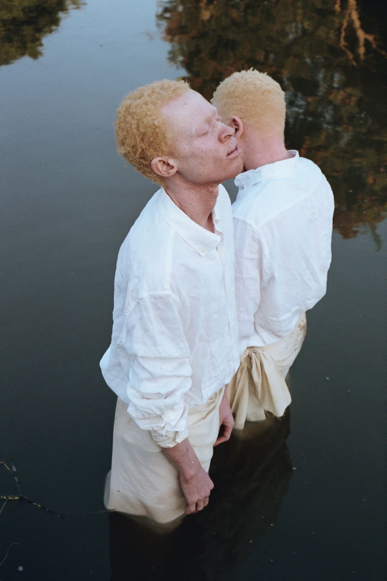 Stunning portraits of young African men living with Albinism | Dazed