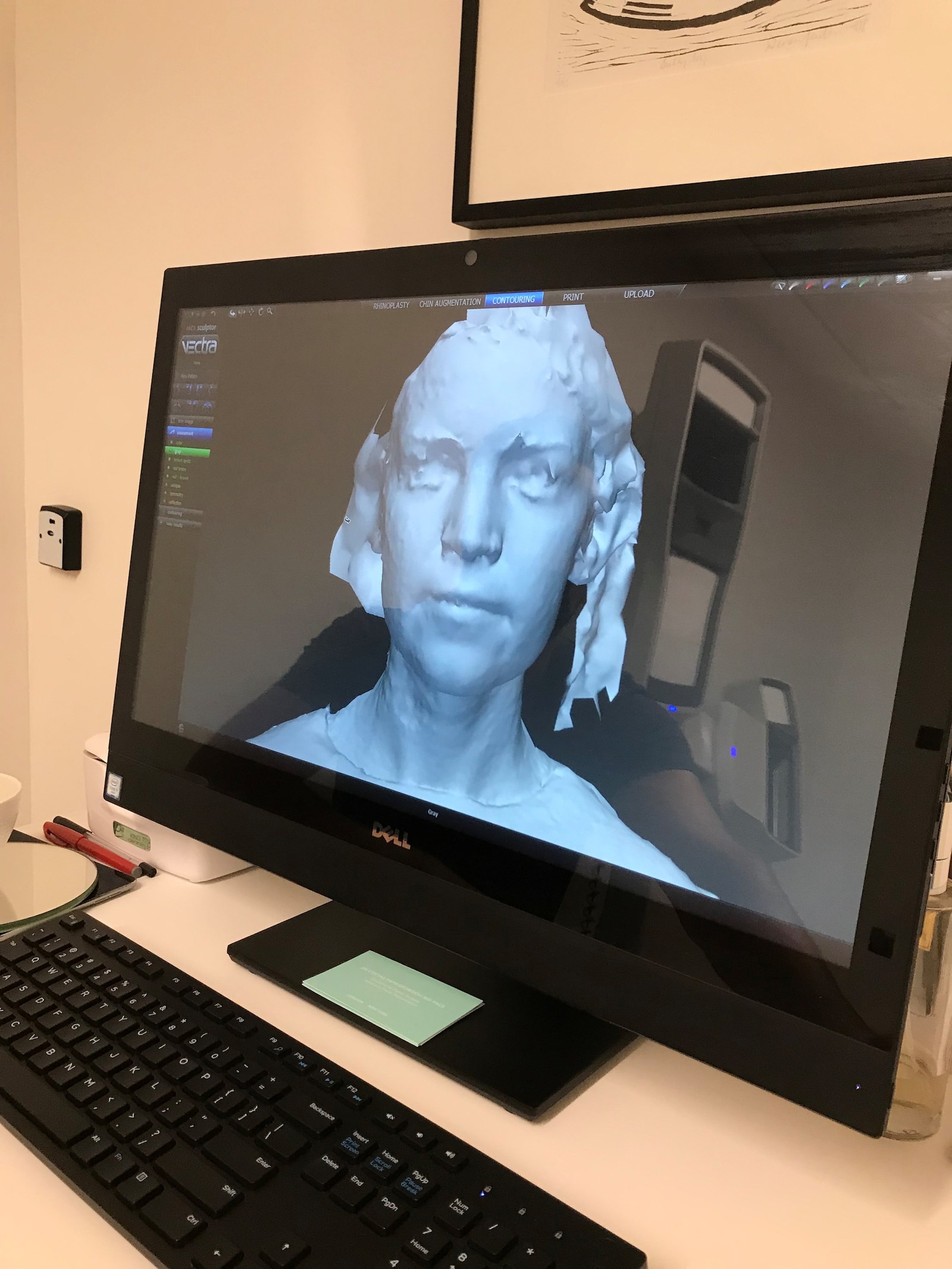 I had my face 3D imaged and lasered in search of symmetry | Dazed