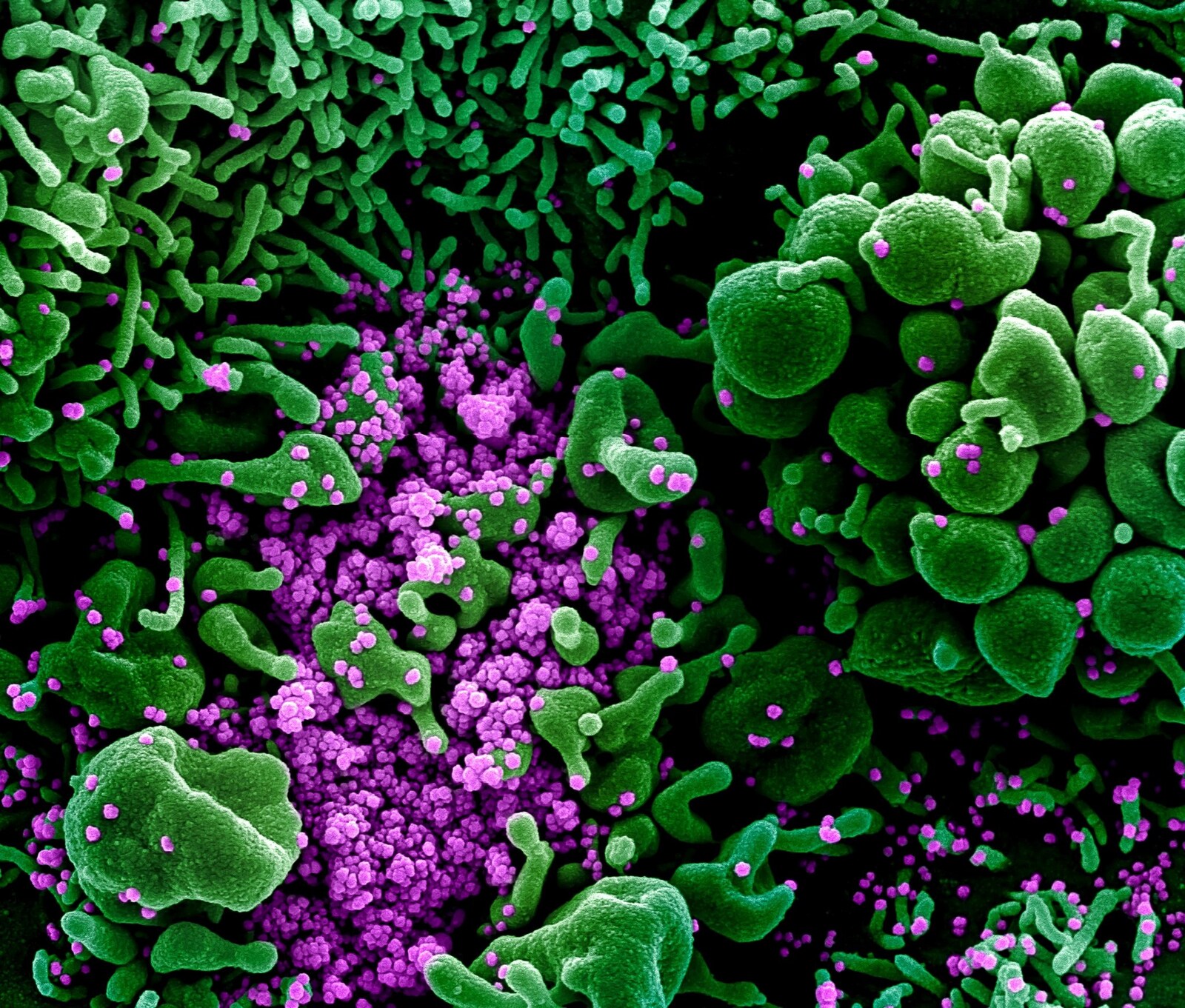 The touch crisis: how we’re changing how we think about germs | Dazed