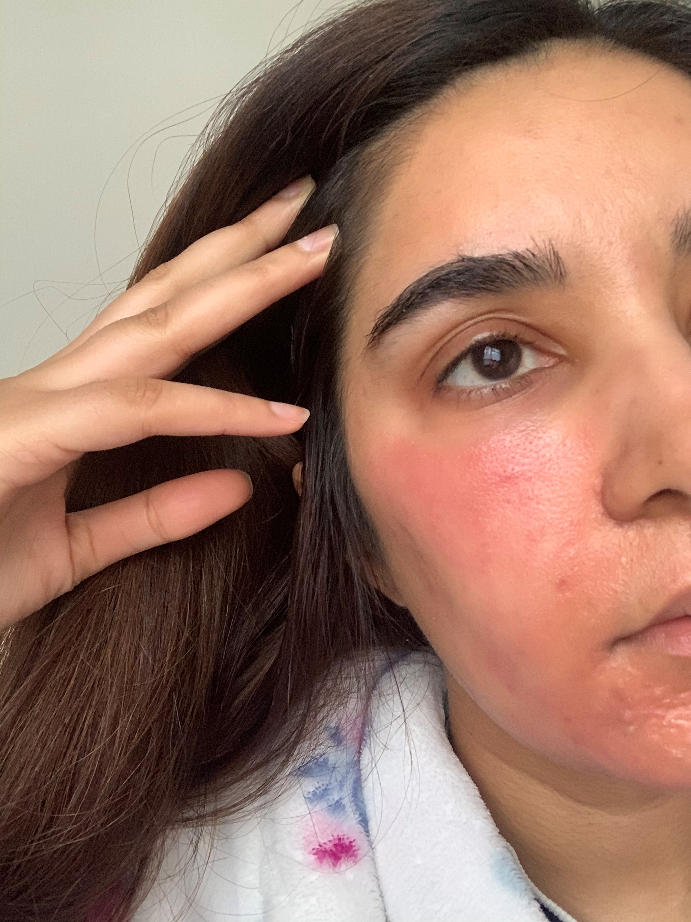 The painful lessons I learned after The Ordinary gave me chemical burns ...