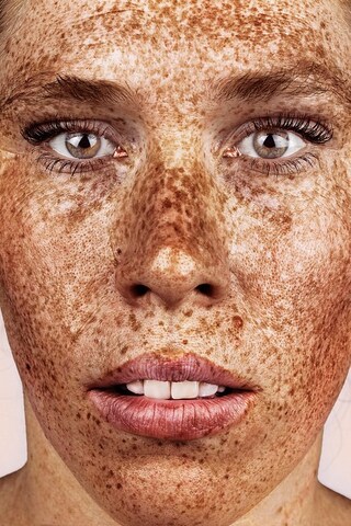 Freckles | Dazed