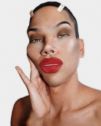 Why has Instagram now decided that botched surgery is cool? | Dazed