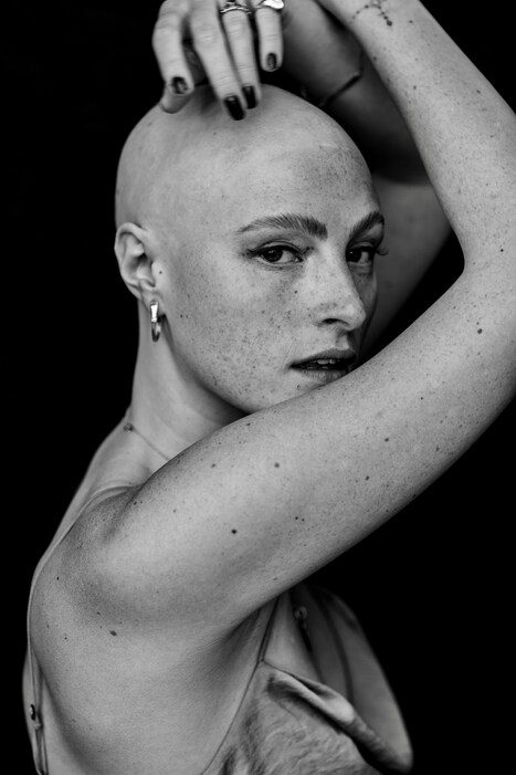 Model Amber Rowan wants to change the conversation about Alopecia | Dazed