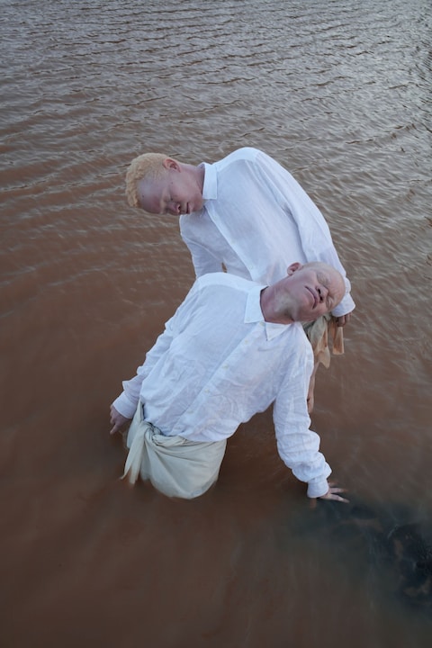 Stunning portraits of young African men living with Albinism | Dazed