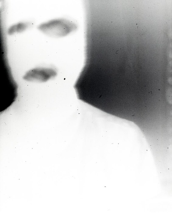 A short history of radical transplants | Dazed