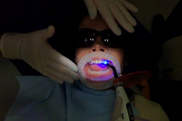 Why I had my teeth filed into fangs | Dazed