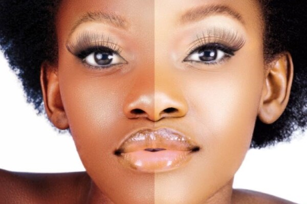 What it means for Rwanda to have banned skin bleaching creams | Dazed