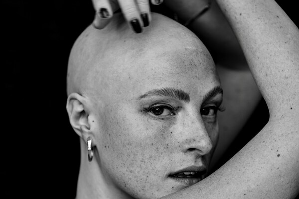 Model Amber Rowan wants to change the conversation about Alopecia | Dazed