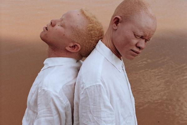 Stunning portraits of young African men living with Albinism | Dazed