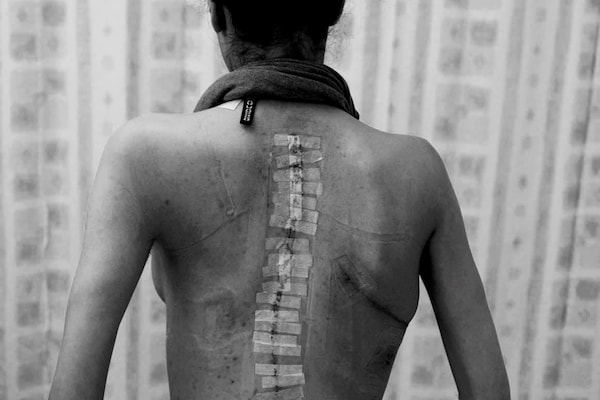 Meet the woman turning her scars into art | Dazed