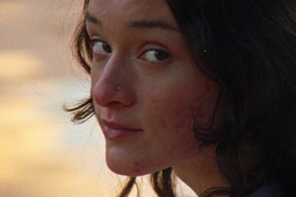 Skin deep: this film explores what it’s like living with a skin ...