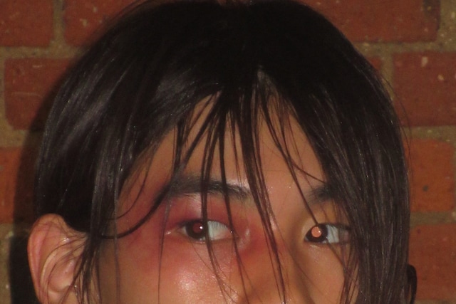 Pain is beauty: How injury became a make-up trend | Dazed