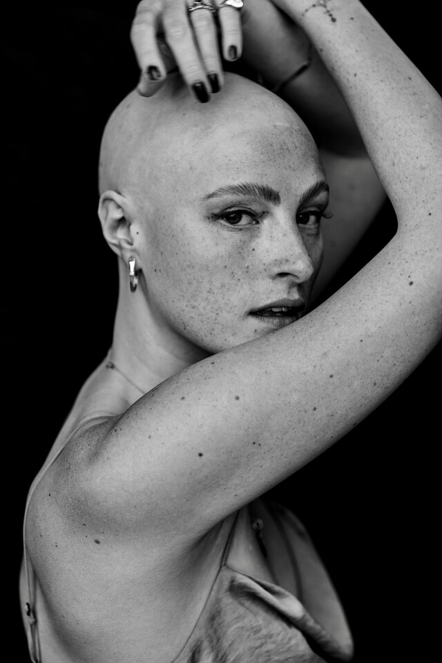 Model Amber Rowan wants to change the conversation about Alopecia | Dazed