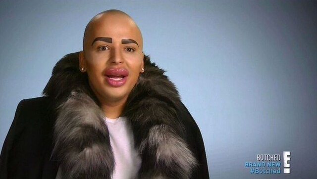 Why we’re so obsessed with plastic surgery TV shows | Dazed