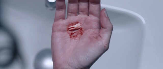 Body horror in The Substance | Dazed