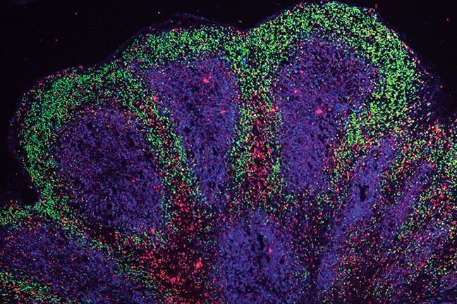 Here’s how scientists are keeping lab-grown human mini-brains alive | Dazed