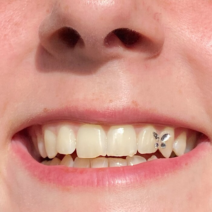 These bedazzled tooth gems are autumn’s hottest Y2K accessory | Dazed