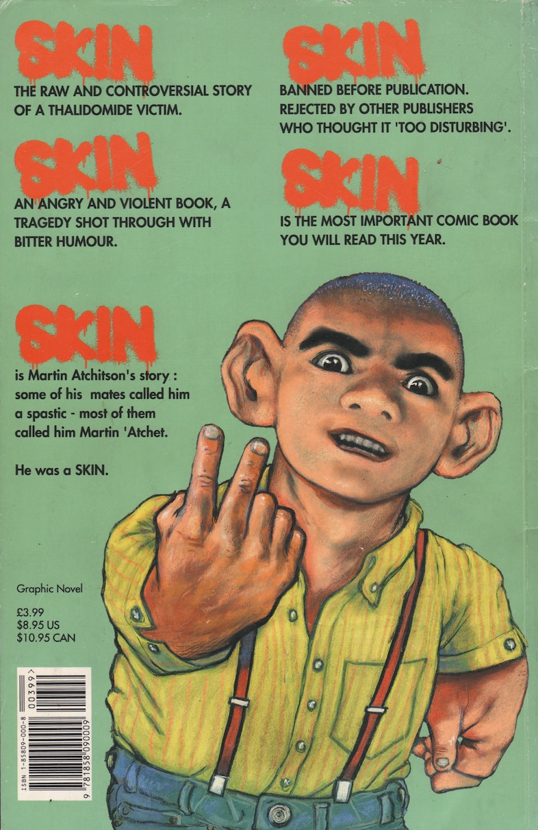 Skinhead: An Archive | Dazed