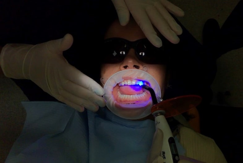 Why I had my teeth filed into fangs | Dazed