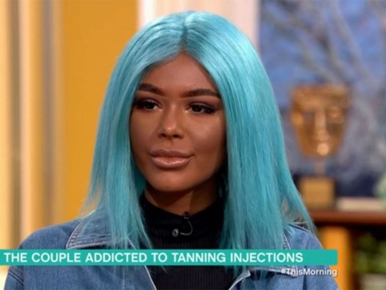 What are ‘melanotan’ injections? Explaining the controversial tanning ...