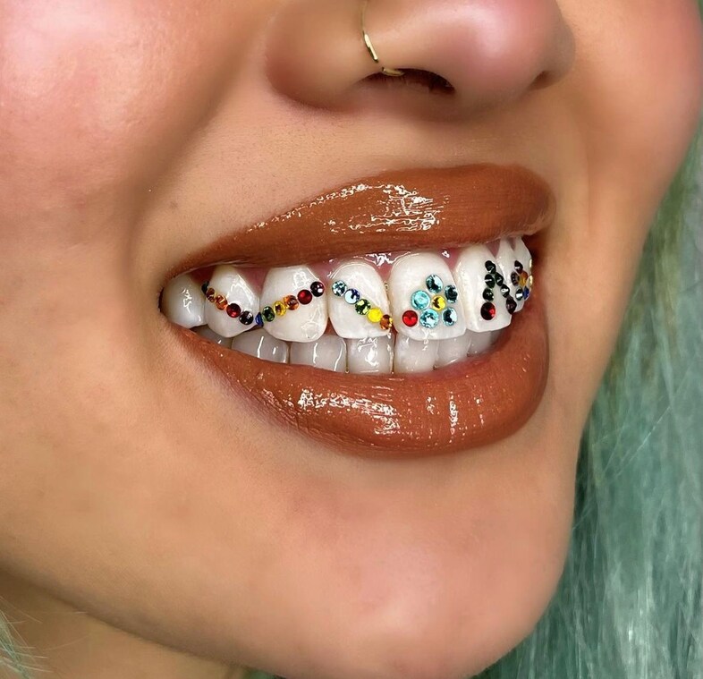 Tooth gems by Graciella Masterton | Dazed